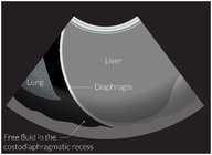 Point-of-care ultrasound - Knowledge @ AMBOSS