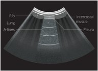 Shock - Knowledge @ AMBOSS