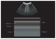 ABCDE approach - Knowledge @ AMBOSS