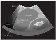 Abdominal cavity - Knowledge @ AMBOSS