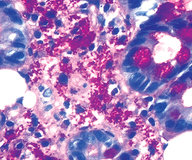 Pathology techniques - Knowledge @ AMBOSS