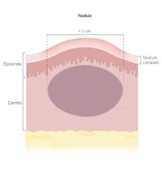 Principles of dermatology - Knowledge @ AMBOSS