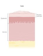 Principles of dermatology - Knowledge @ AMBOSS