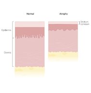 Principles of dermatology - Knowledge @ AMBOSS