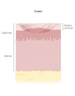 Principles of dermatology - Knowledge @ AMBOSS