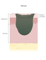 Principles of dermatology - Knowledge @ AMBOSS