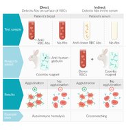 Hemolytic anemia - Knowledge @ AMBOSS