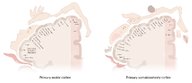 The somatosensory system - Knowledge @ AMBOSS
