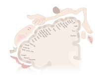 Overview of stroke - Knowledge @ AMBOSS