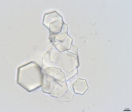 Nephrolithiasis - Knowledge @ AMBOSS
