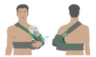 Shoulder dislocation - Knowledge @ AMBOSS