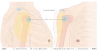 Shoulder reduction - Knowledge @ AMBOSS
