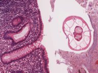 Helminth infections - Knowledge @ AMBOSS