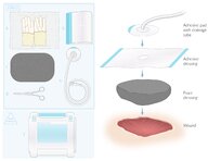 Decubitus ulcers - Knowledge @ AMBOSS