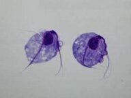 General parasitology - Knowledge @ AMBOSS