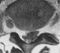 Sciatica Knowledge Amboss