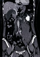 Back pain - Knowledge @ AMBOSS