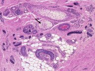 Skin and skin appendage - Knowledge @ AMBOSS