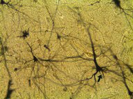The cerebral cortex, meninges, basal ganglia, and ventricular system ...