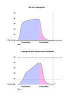 ABCDE approach - Knowledge @ AMBOSS