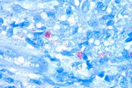 Bacteria overview - Knowledge @ AMBOSS