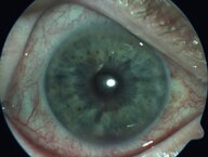 Eye pain and red eye - Knowledge @ AMBOSS