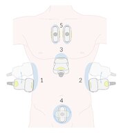 Point-of-care ultrasound - Knowledge @ AMBOSS