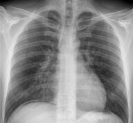 Abdominal cavity - Knowledge @ AMBOSS