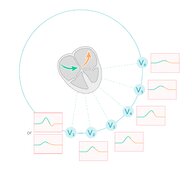 ECG - Knowledge @ AMBOSS