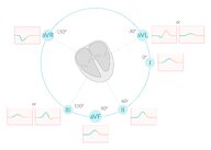 ECG - Knowledge @ AMBOSS