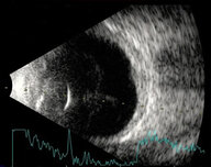 Traumatic eye injuries - Knowledge @ AMBOSS