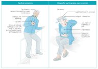 Acute coronary syndrome - Knowledge @ AMBOSS