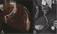 Ventricular tachycardia - Knowledge @ AMBOSS