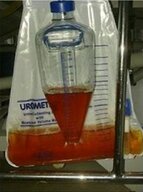 Tuberculosis - Knowledge @ AMBOSS