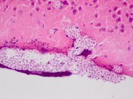 HIV-associated conditions - Knowledge @ AMBOSS