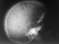 Anemia - Knowledge @ AMBOSS