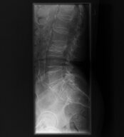 Back pain - Knowledge @ AMBOSS