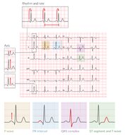ECG - Knowledge @ AMBOSS