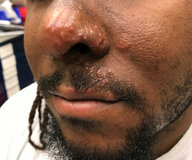 Eye pain and red eye - Knowledge @ AMBOSS