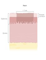 Principles of dermatology - Knowledge @ AMBOSS
