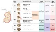 Renal cysts - Knowledge @ AMBOSS