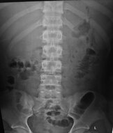 Acute pancreatitis - Knowledge @ AMBOSS