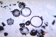 Overview of fungal infections - Knowledge @ AMBOSS
