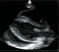 Management of trauma patients - Knowledge @ AMBOSS