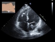 Point-of-care ultrasound - Knowledge @ AMBOSS