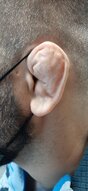 Ear injuries - Knowledge @ AMBOSS