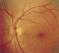 Eye pain and red eye - Knowledge @ AMBOSS