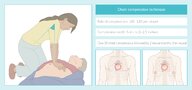 Cardiac arrest and cardiopulmonary resuscitation - Knowledge @ AMBOSS
