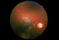 Examination of the eye - Knowledge @ AMBOSS