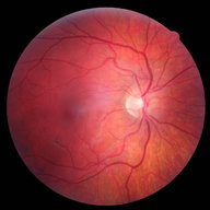 Examination of the eye - Knowledge @ AMBOSS